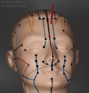 Acupuncture point forehead - Acupuncture & Wellness Updates